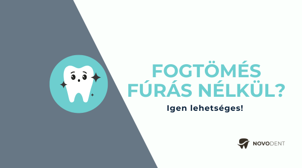 Fogtömés nélkül is megállítható a fogszuvasodás? - Novodent Szeged